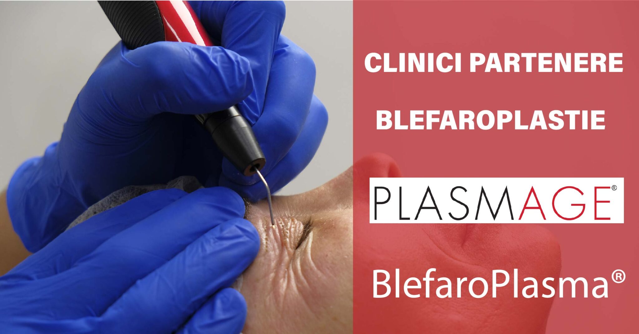 Blefaroplastie cu PLASMAGE - Clinici Partenere - Medical Estetic Line